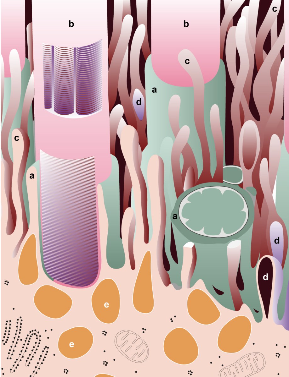 Age related macular degeneration – Martyn James Bull